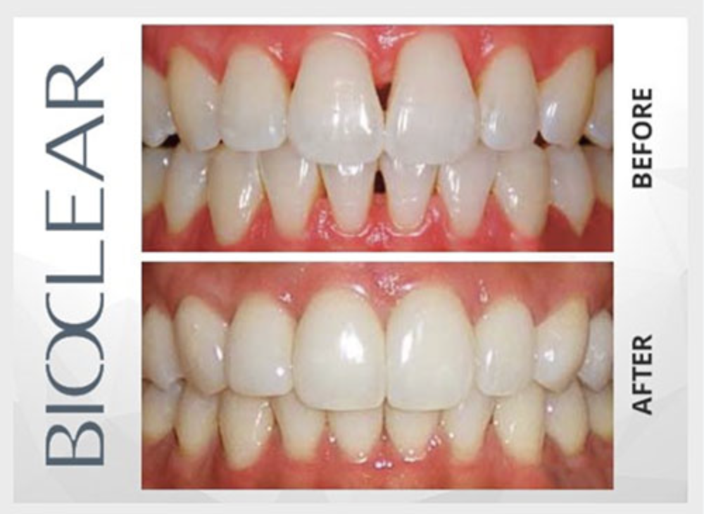 Biological Dentistry — Janssen Dental Clinic